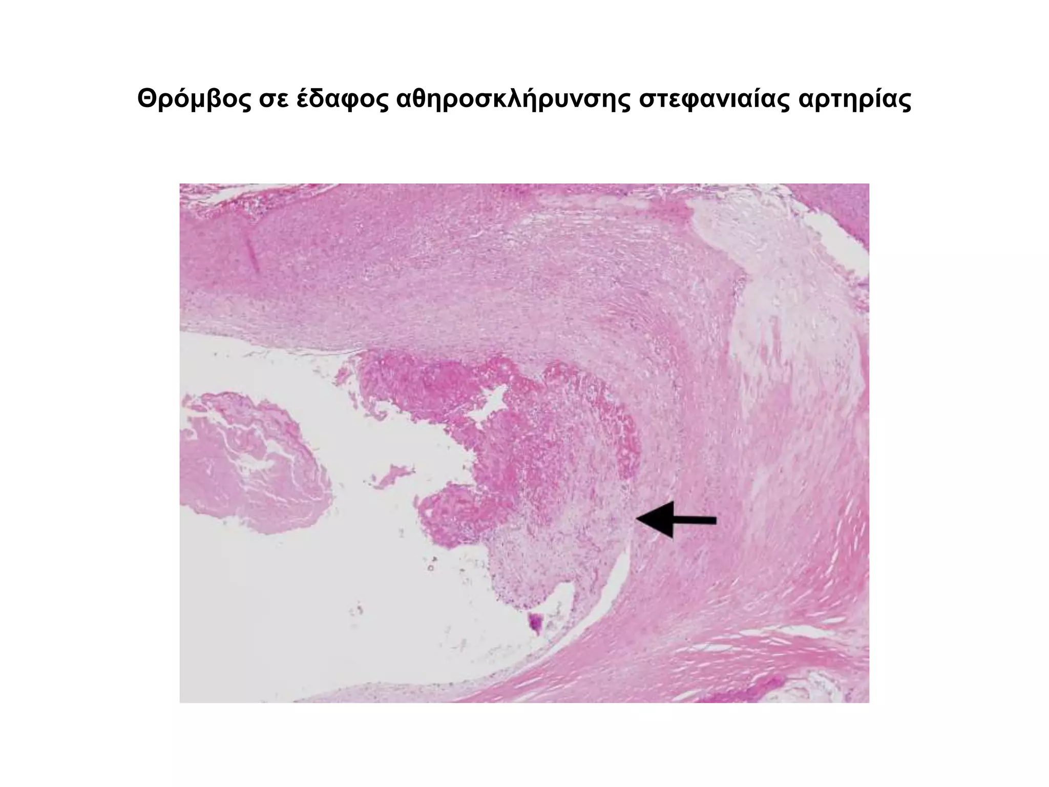 AIMOΔΥΝΑΜΙΚΕΣ ΔΙΑΤΑΡΑΧΕΣ.ppt