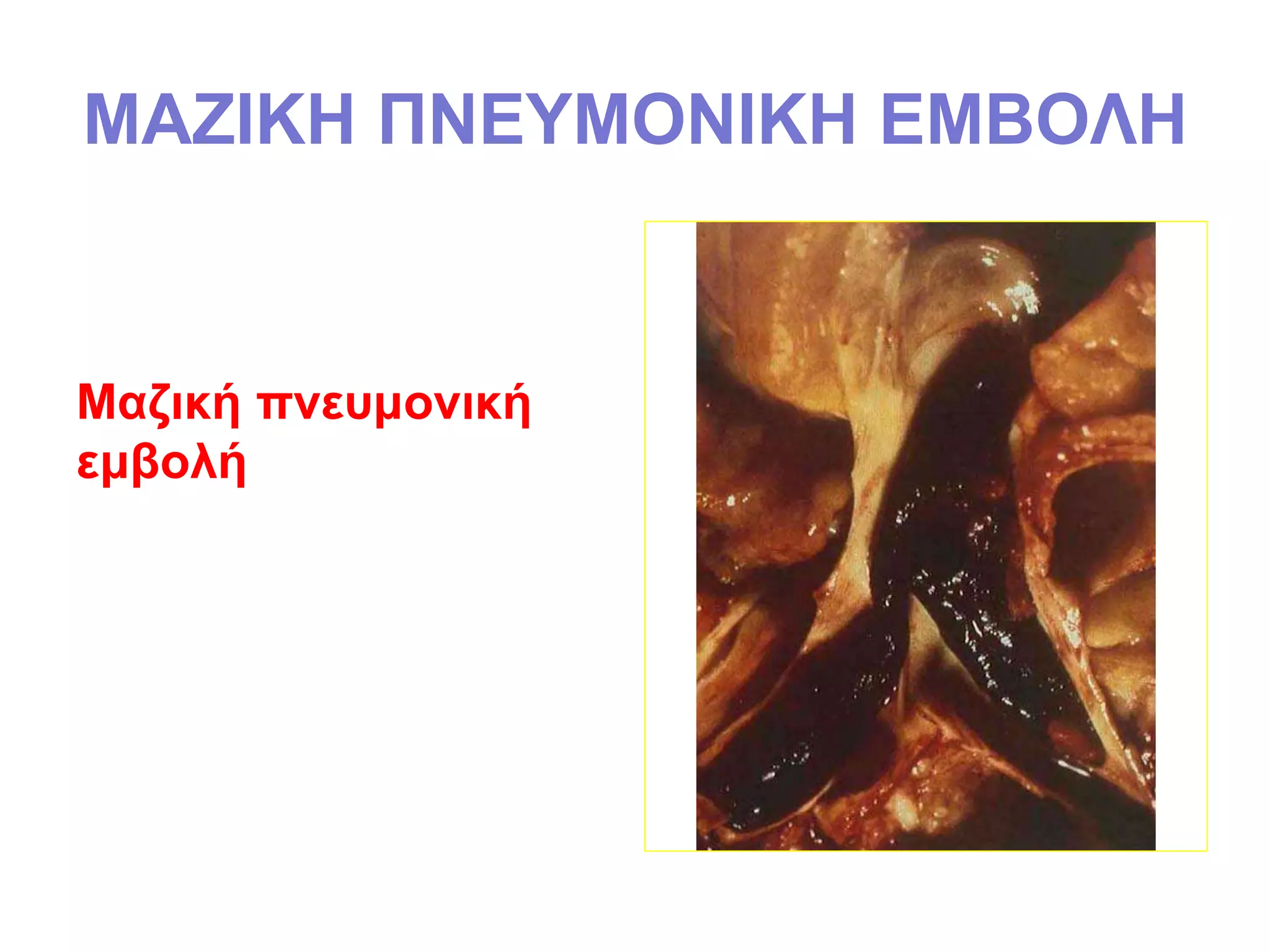 AIMOΔΥΝΑΜΙΚΕΣ ΔΙΑΤΑΡΑΧΕΣ.ppt