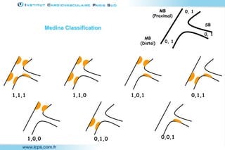 Louvard Y - AIMRADIAL 2014 Technical - Bifurcation and radial approach ...