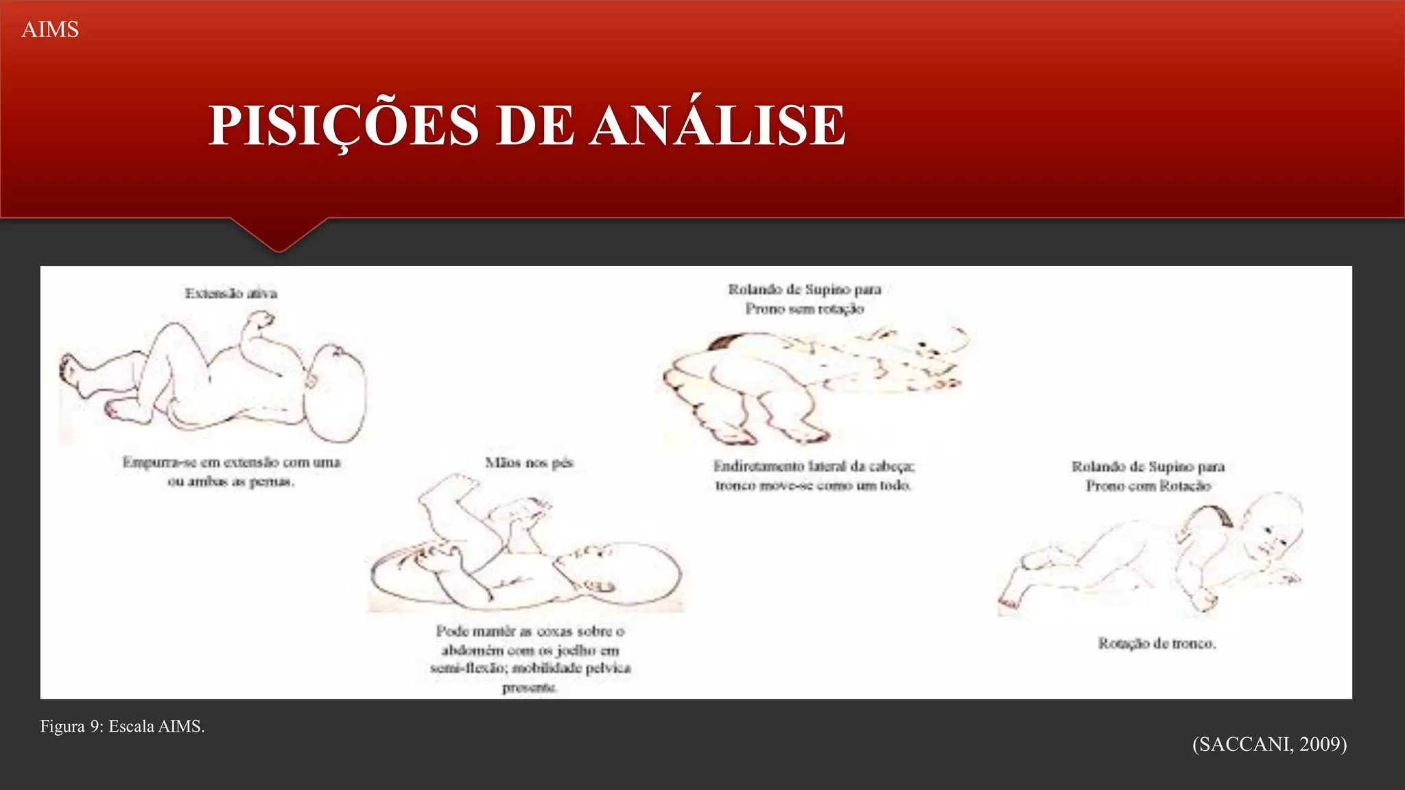 ESCALA MOTORA INFANTIL DE ALBERTA - AIMS | PDF