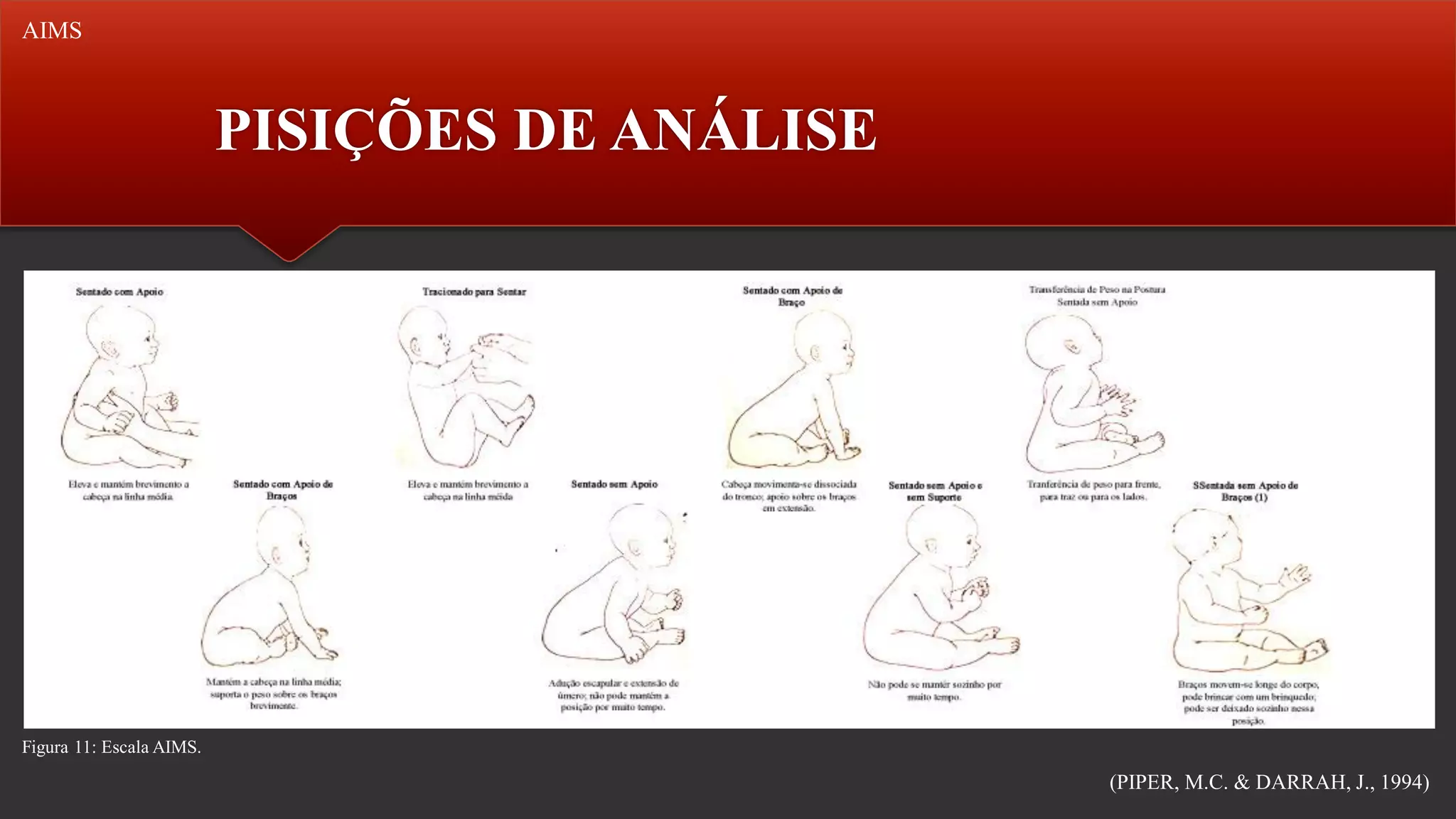 ESCALA MOTORA INFANTIL DE ALBERTA - AIMS | PDF