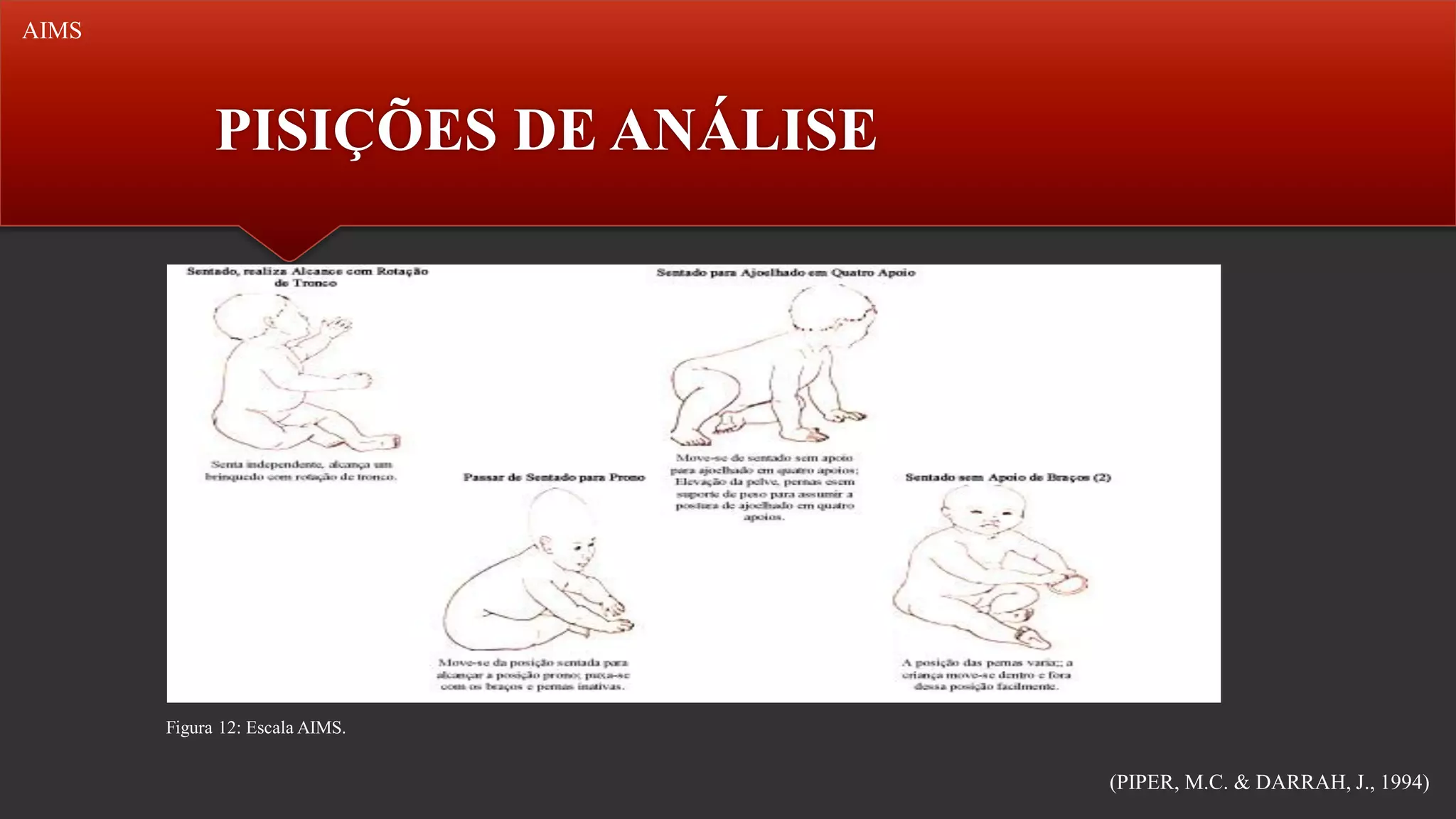 ESCALA MOTORA INFANTIL DE ALBERTA - AIMS | PDF