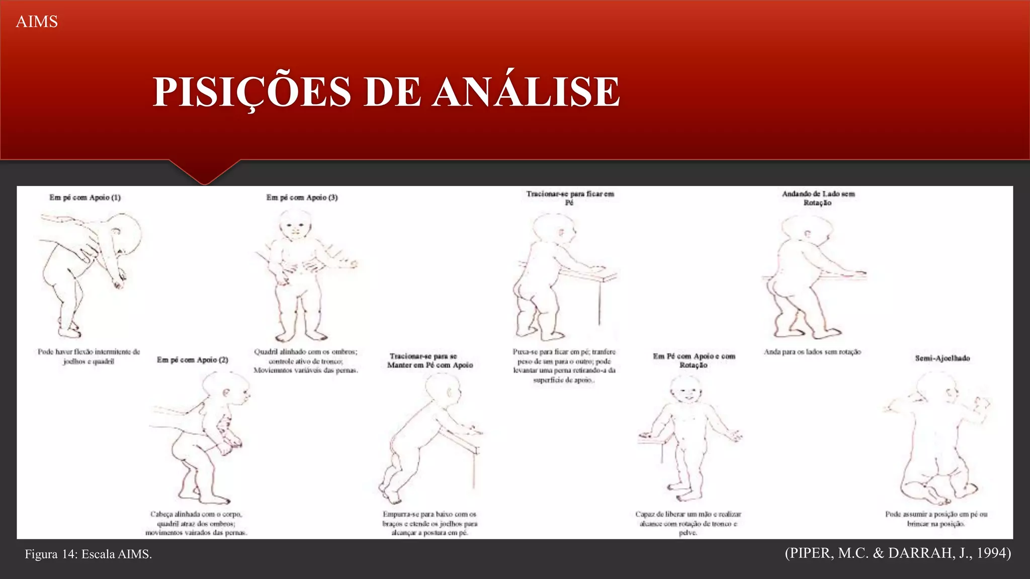 ESCALA MOTORA INFANTIL DE ALBERTA - AIMS | PDF