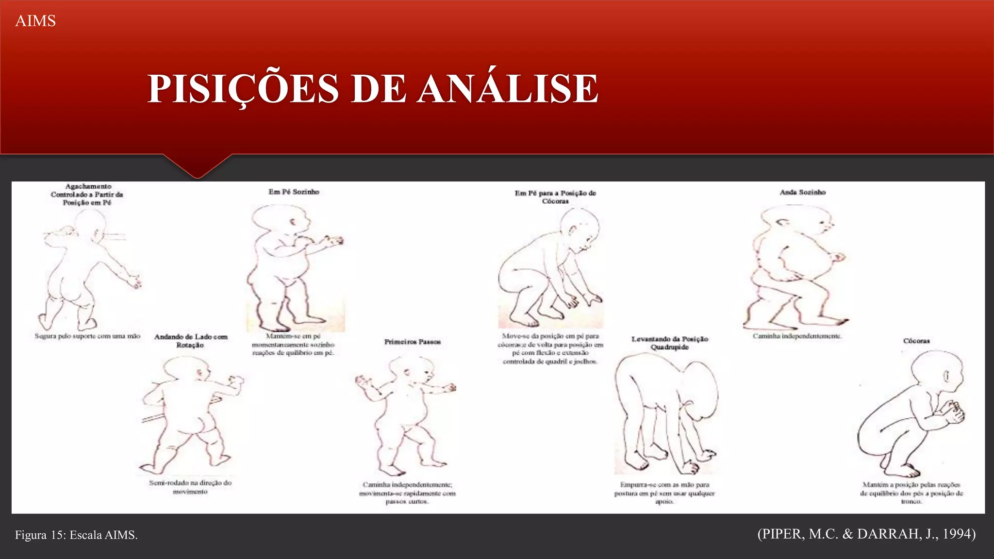 ESCALA MOTORA INFANTIL DE ALBERTA - AIMS | PDF