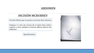 Incisiones quirúrgicas de 5to semestre enfermeria | PPTX