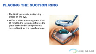 Current overview of Microkeratomes | PPTX
