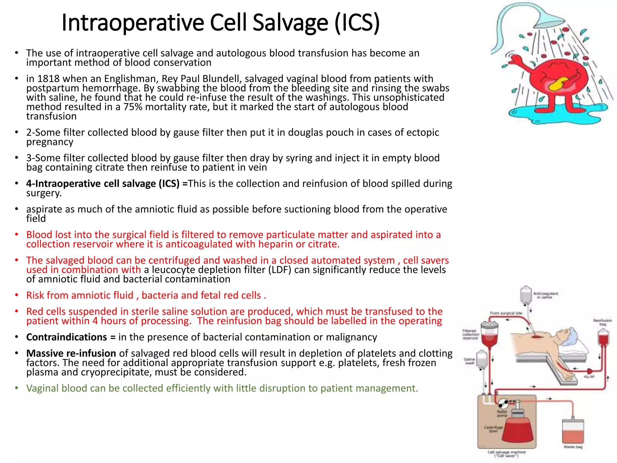 Abnormal Invasive Placenta | PPTX