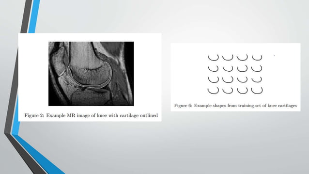 AI Presentation- Human Face Detection Techniques- By Sudeep KC | PPT