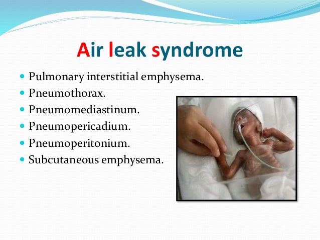 Air Leak Syndrome