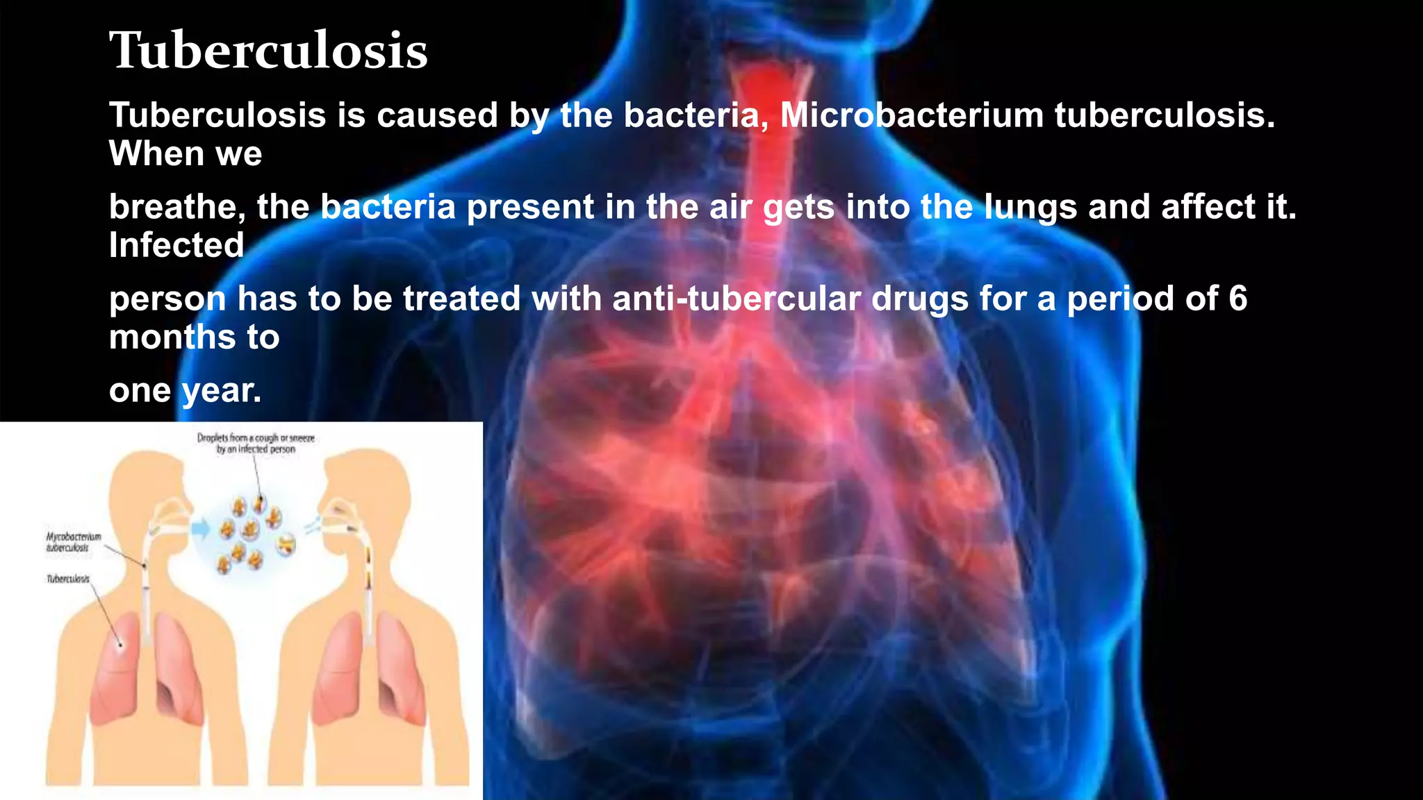 Airborne diseases | PPTX | Cold and Flu | Diseases and Conditions