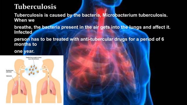 Airborne diseases | PPTX | Cold and Flu | Diseases and Conditions
