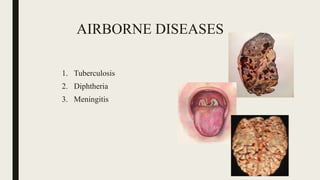 Airborne diseases | PPT