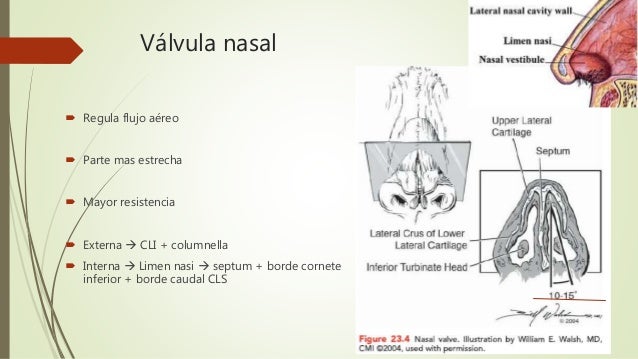 Airflow and patient perceived improvement following rhinoplastic corr…