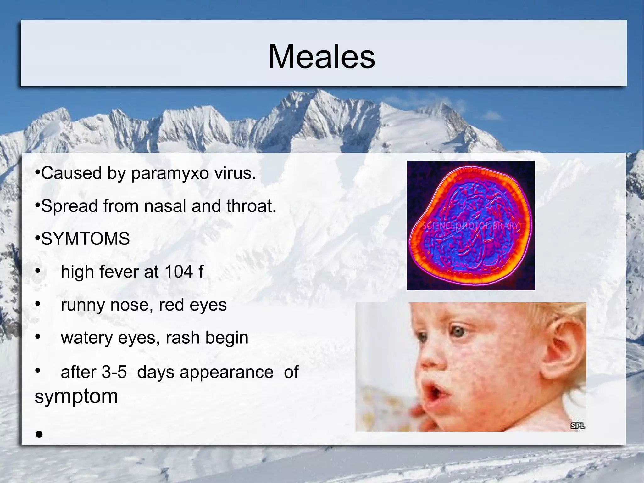 Air borne diseases. | ODP
