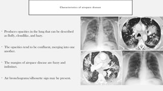 Pathologies of the airspace disease.pptx
