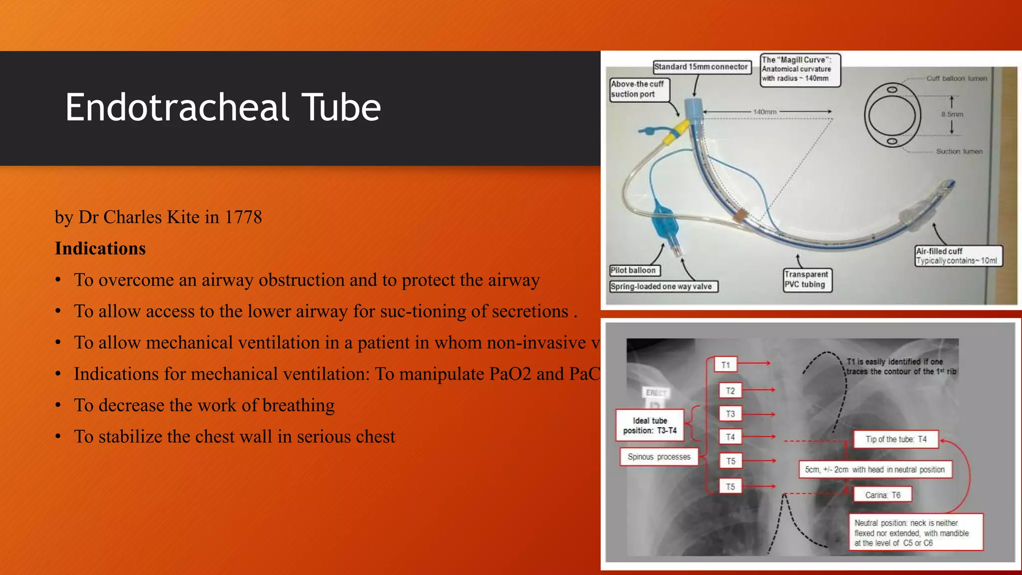 Airway | PPTX