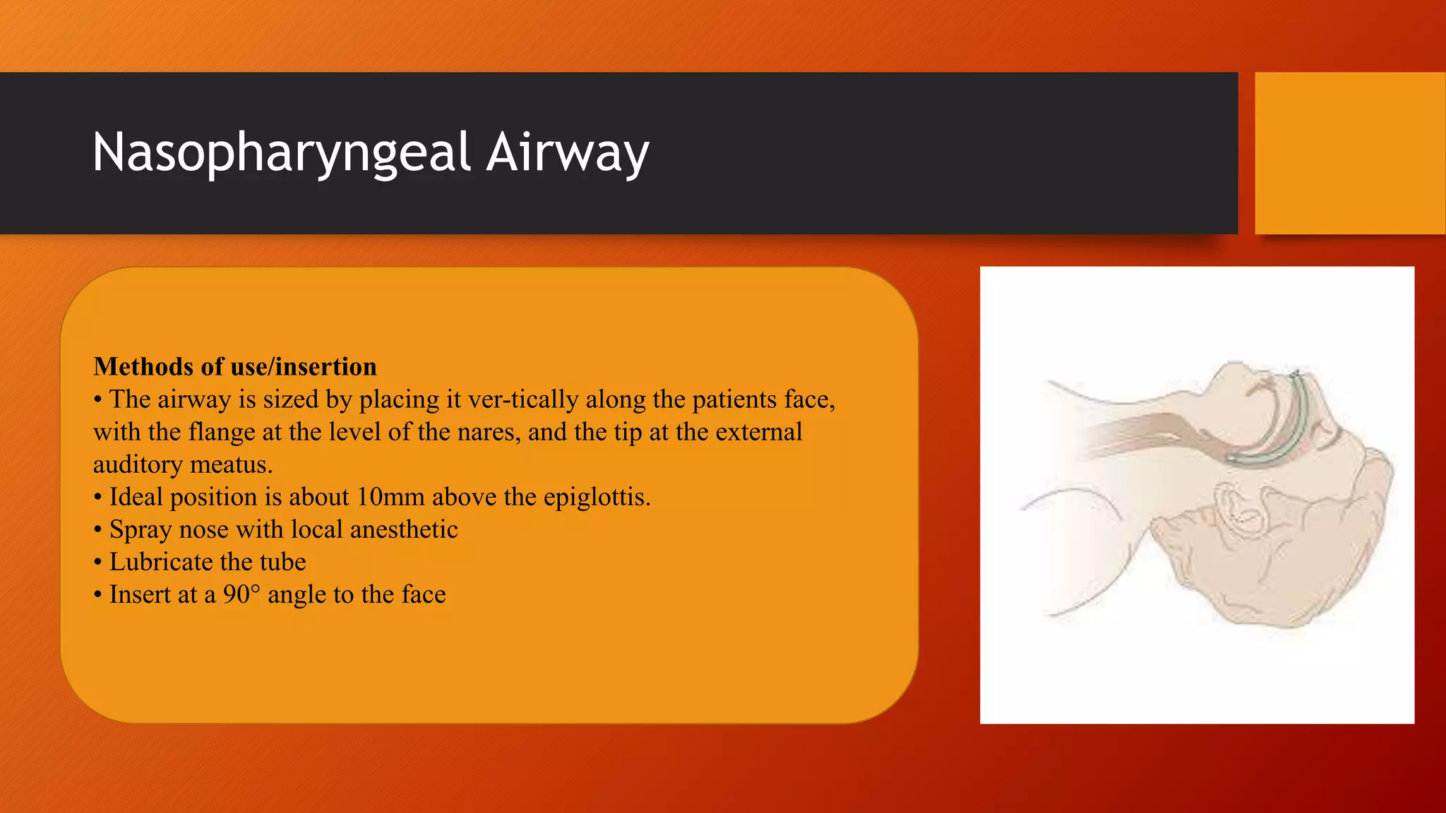 Airway | PPTX