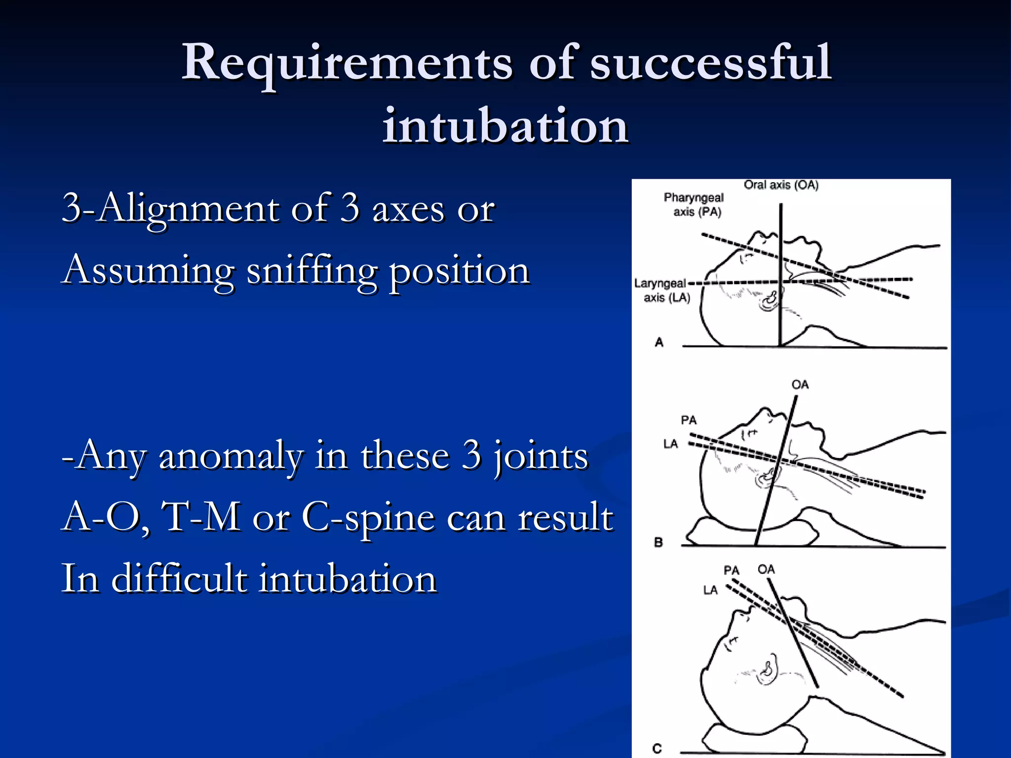 Airway Evaluation and Management | PPT