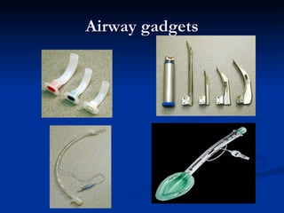 Airway Evaluation and Management | PPT