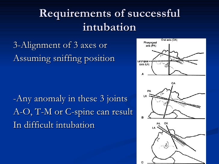 Airway Evaluation and Management