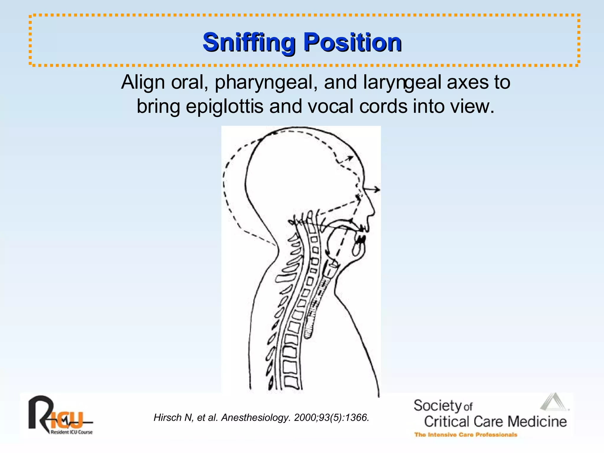 Airway Management | PPT