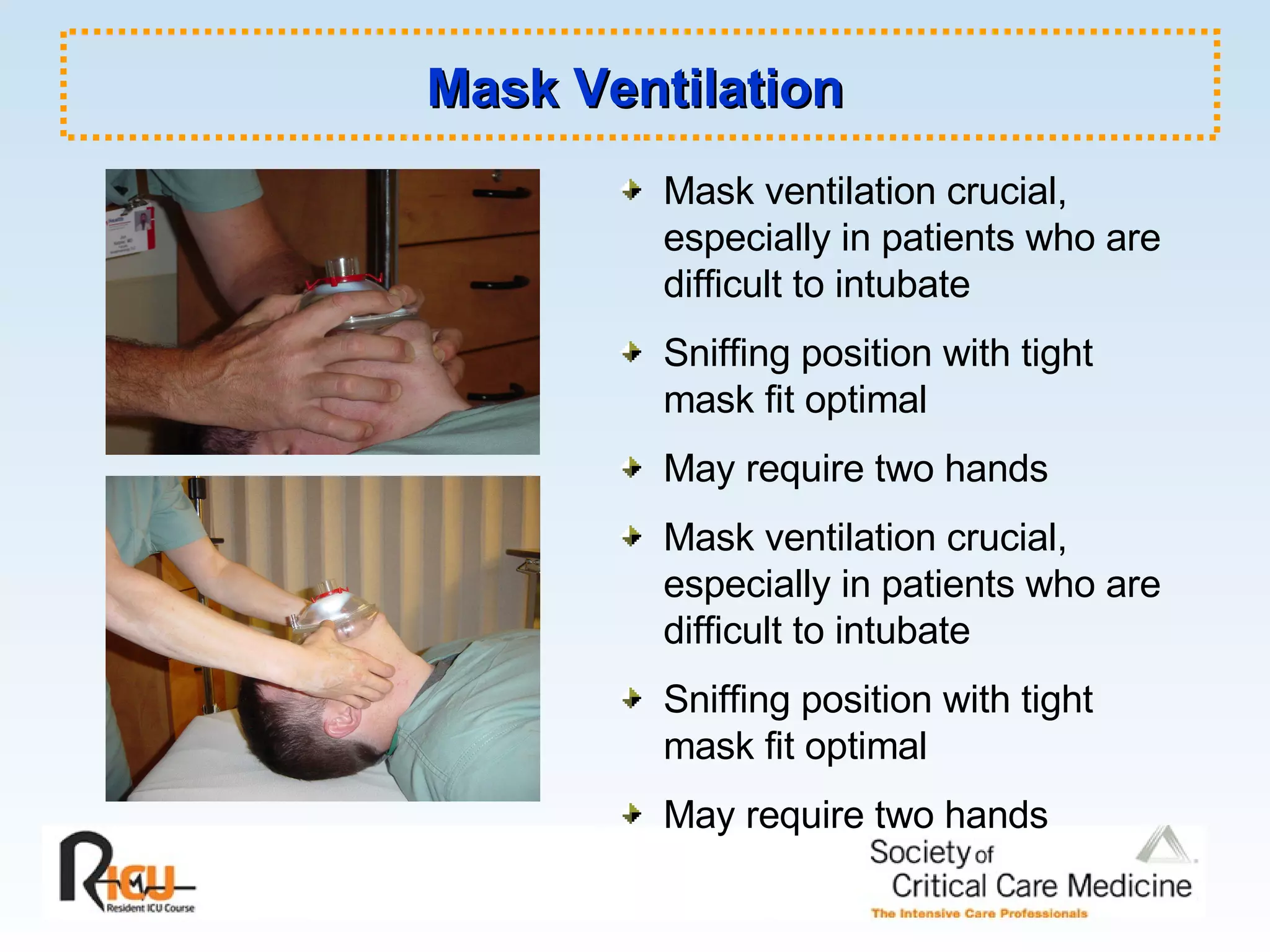 Airway Management | PPT
