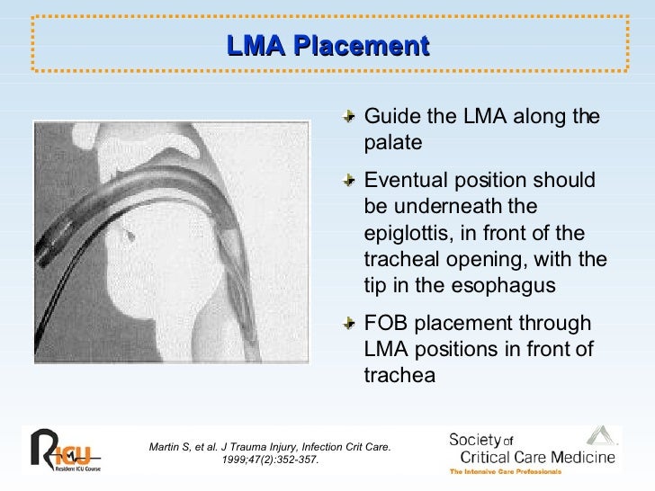 Airway Management
