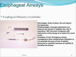 Airway Manegement | PPT