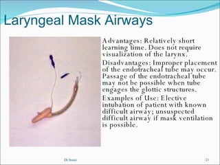 Airway Manegement | PPT