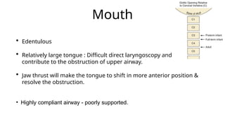 Applied anatomy in paediatric anaesthesia | PPTX