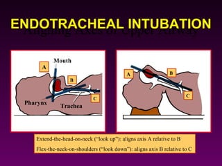Airway adjuncts and management in ACLS | PPT