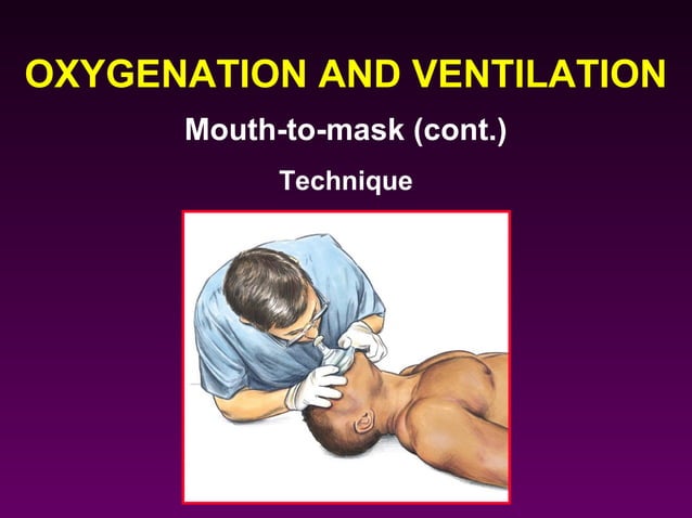 Airway adjuncts and management in ACLS | PPT | First Aid | Injuries