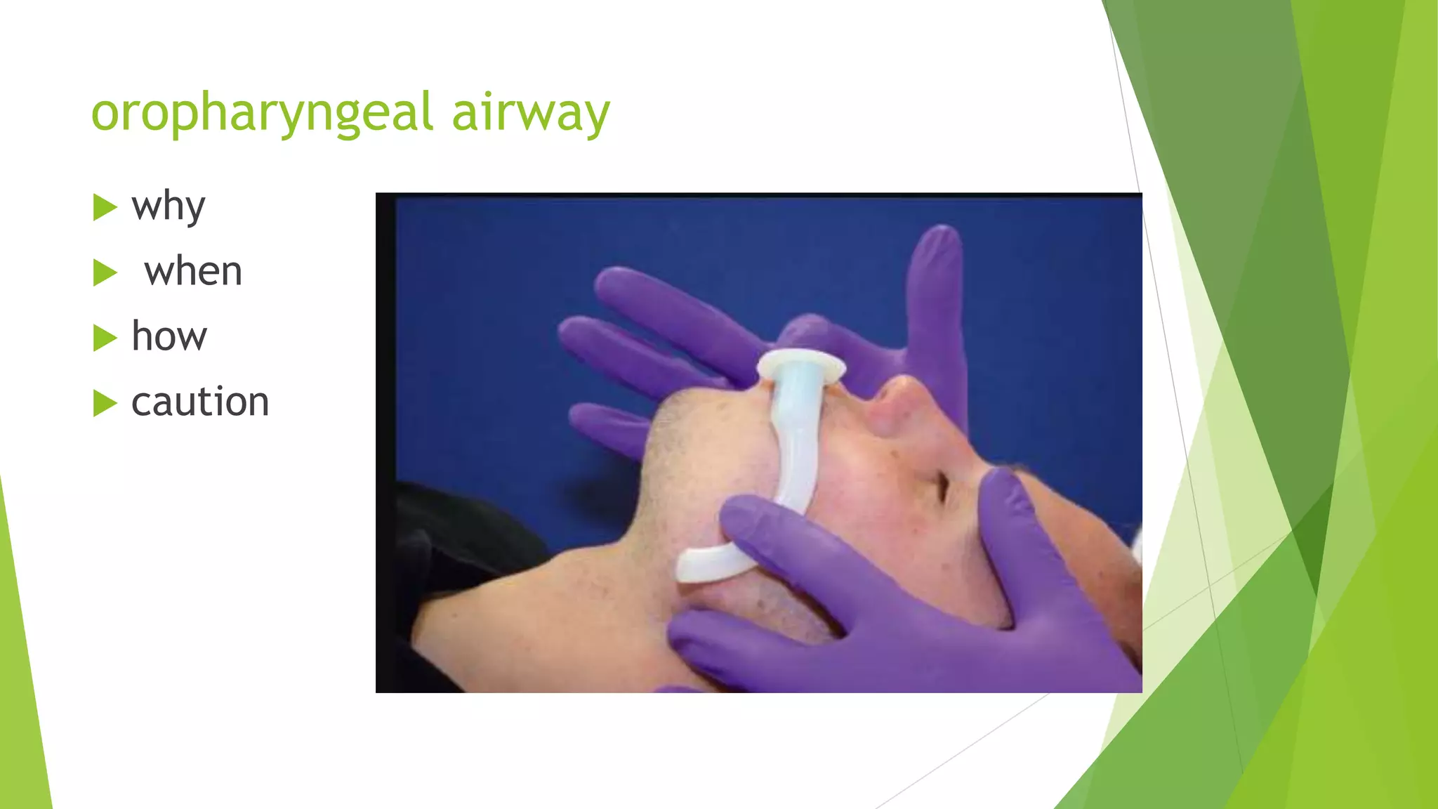 Airway adjuncts | PPTX