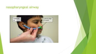 Airway adjuncts | PPTX