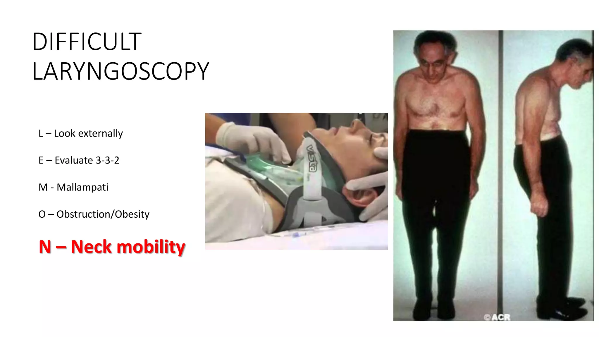 AIRWAY ALGORITHM.pptx