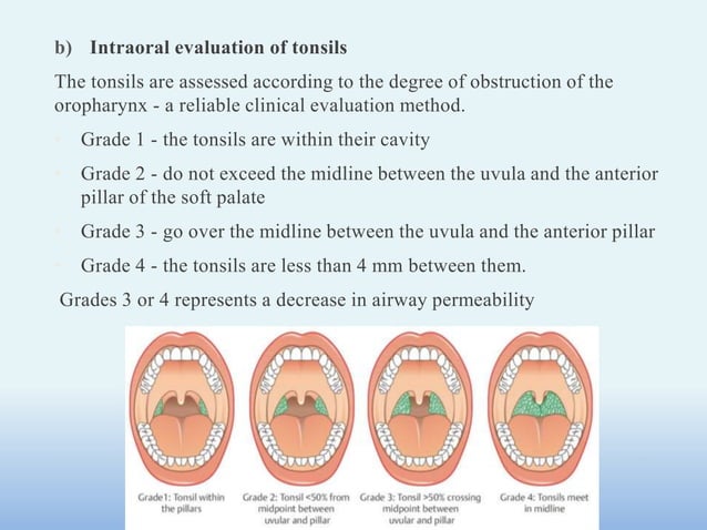 Airway analysis and its relevance in orthodontics | PPTX