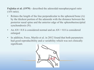 Airway analysis and its relevance in orthodontics | PPTX