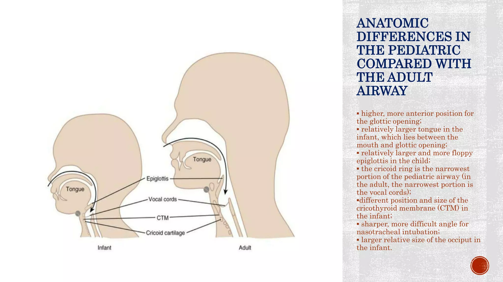 Airway anatomy | PPTX