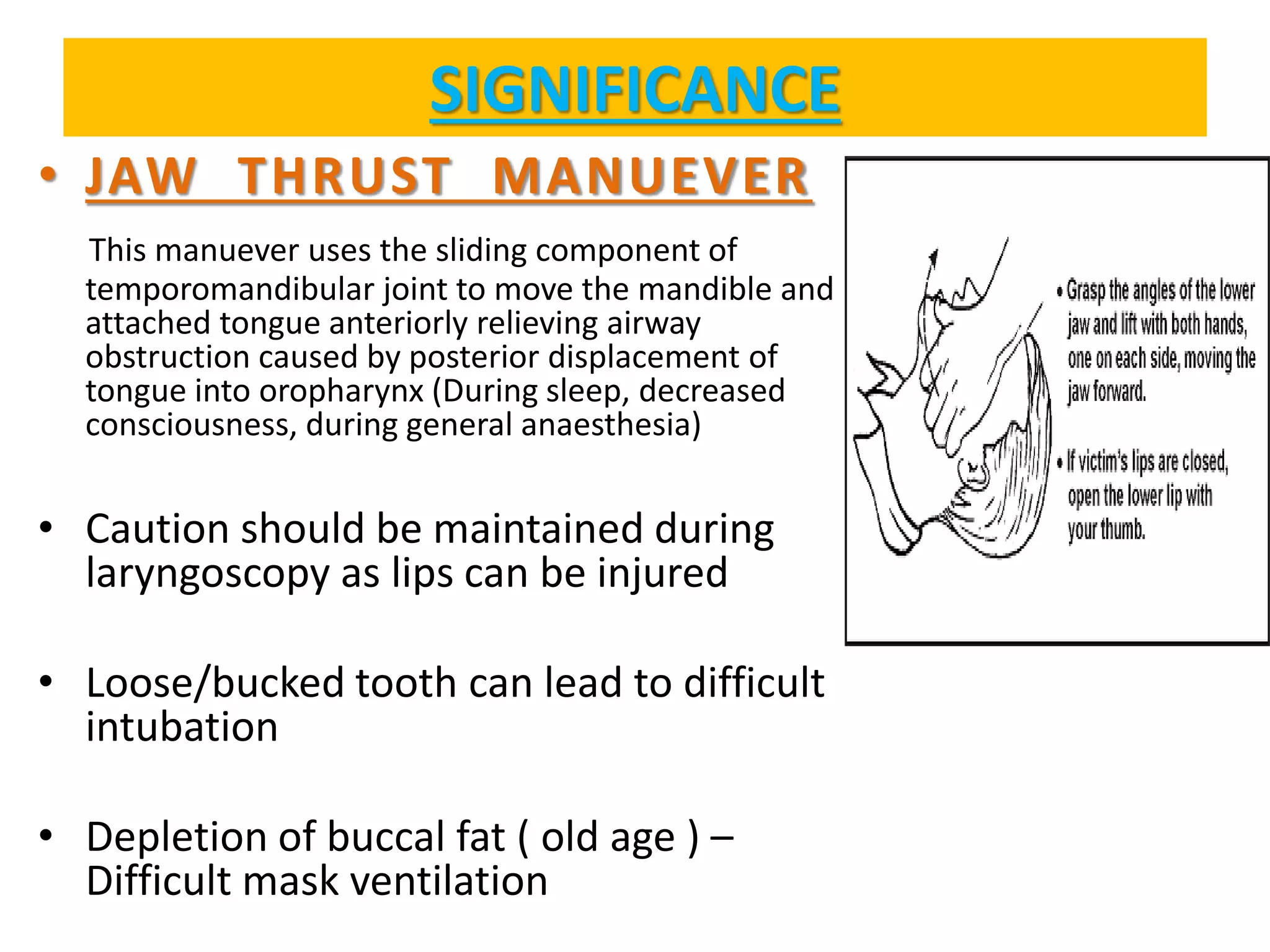 Airway anatomy its assessment and anaesthetic implication | PPTX