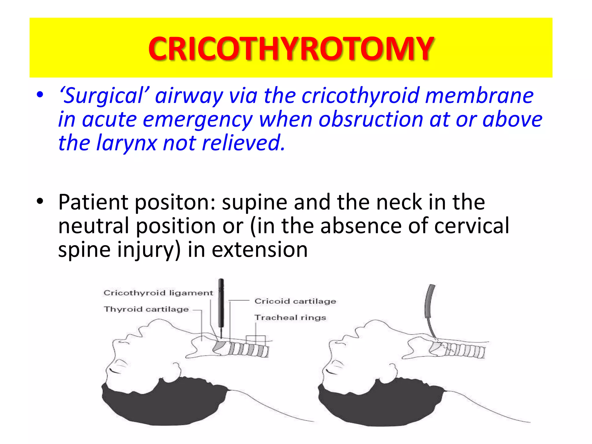 Airway anatomy its assessment and anaesthetic implication | PPTX