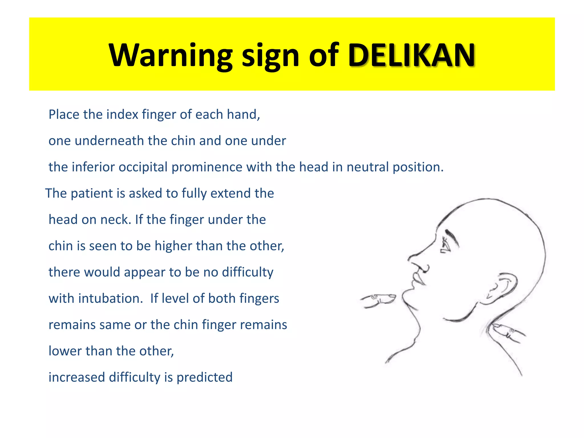 Airway anatomy its assessment and anaesthetic implication | PPTX
