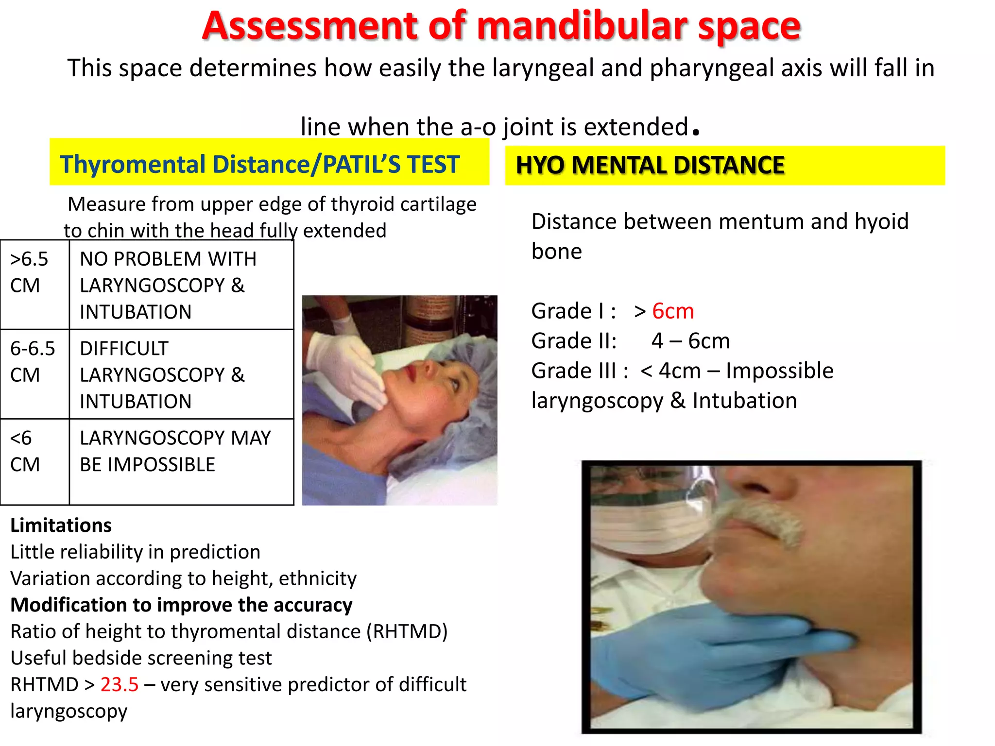 Airway anatomy its assessment and anaesthetic implication | PPTX