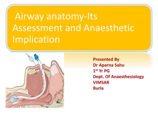 Airway anatomy its assessment and anaesthetic implication | PPTX