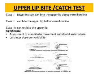Airway anatomy its assessment and anaesthetic implication | PPTX