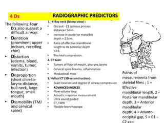 Airway anatomy its assessment and anaesthetic implication | PPTX