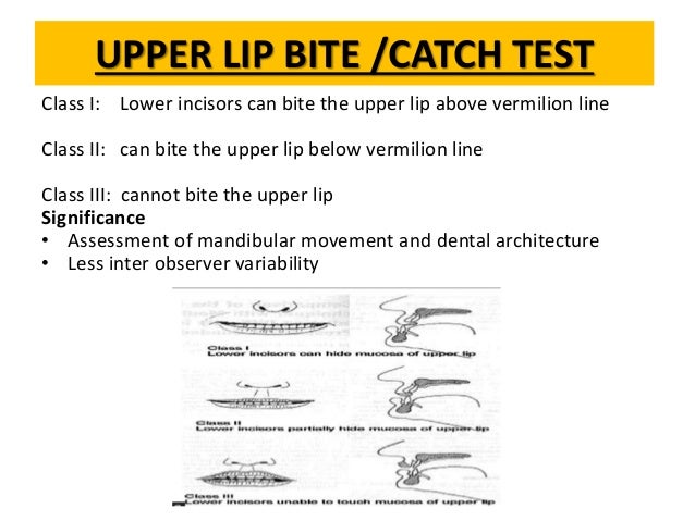 Upper Lip Bite Test Anterior Crossbite Treatment With Clear Aligners: