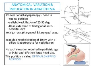 airwayanatomy-ramprasad-160830143137.pptx