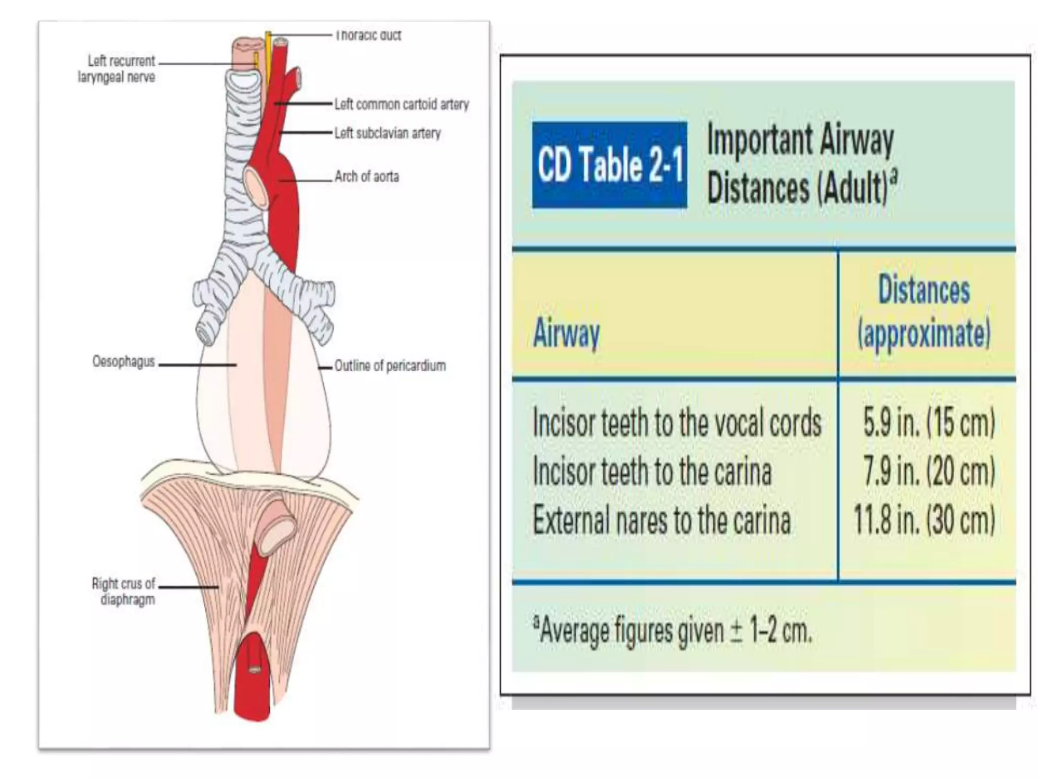 Airway anatomy | PPTX