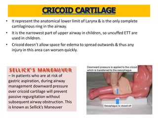 airway anatomy 1.pptx