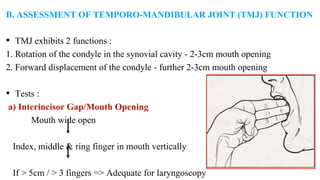 Airway Anatomy & Evaluation PPT.pptx